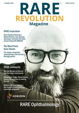 Rare Revolution